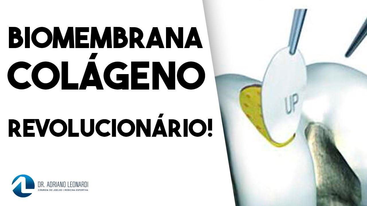 Regeneração da cartilagem pela Biomembrana de colágeno - Especialista ...