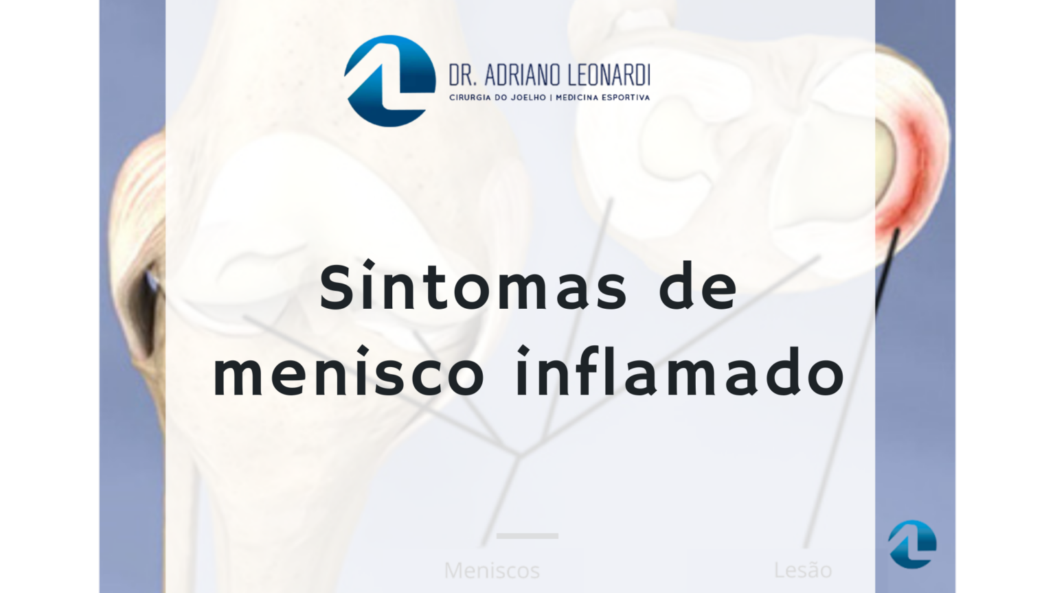 Menisco rompido, o que fazer?